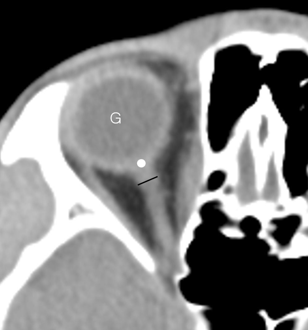 Signa Vitae-Journal of Anesthesiology, Intensive Care Journal ...