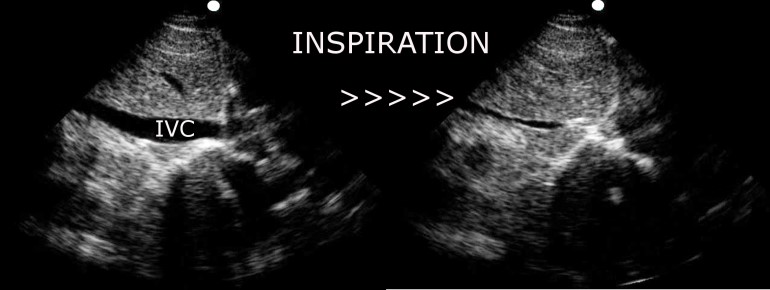 Signa Vitae-Journal of Anesthesiology, Intensive Care Journal ...