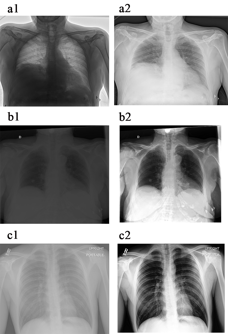 Signa Vitae-Journal of Anesthesiology, Intensive Care Journal ...